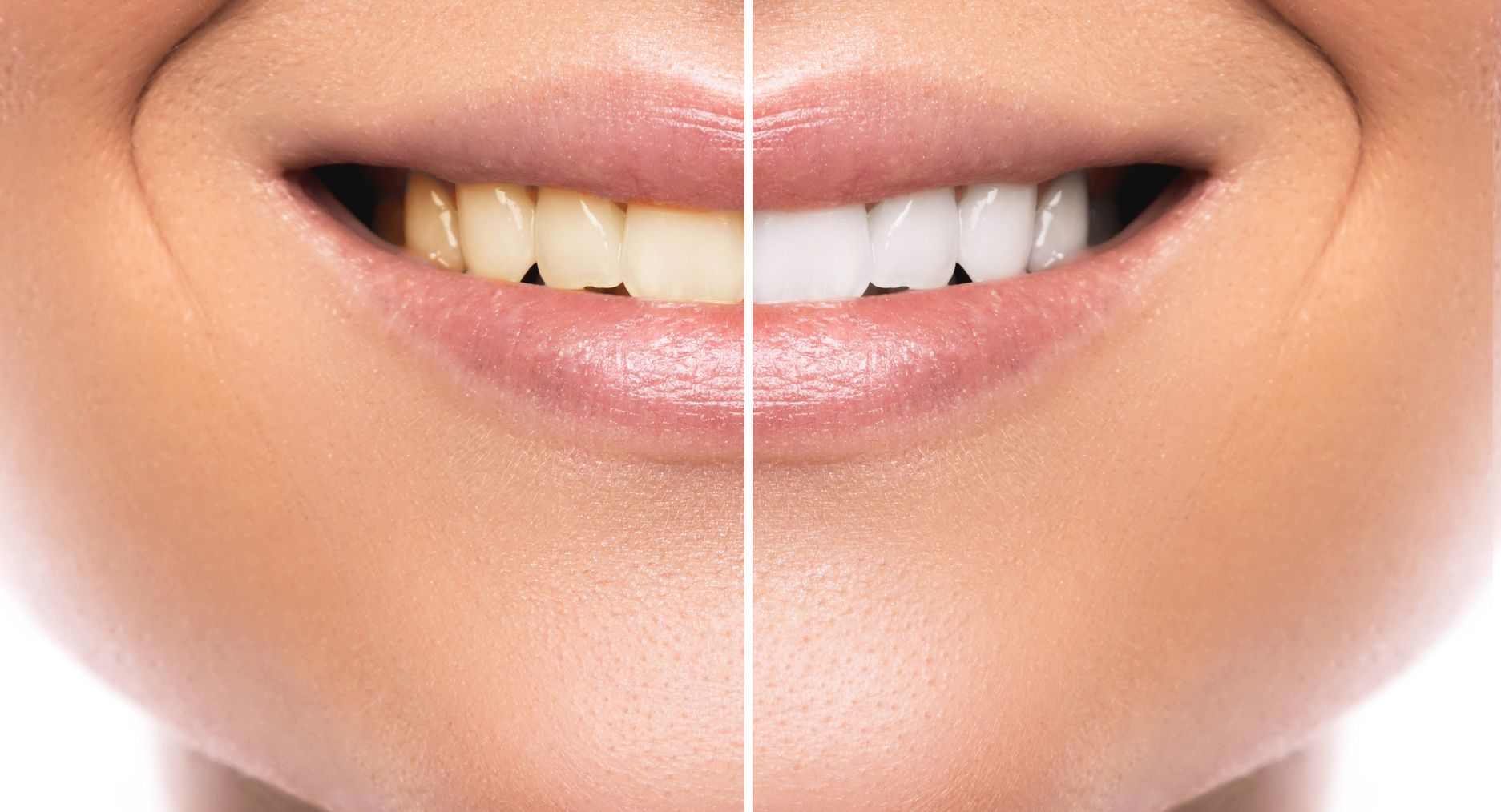 A Step-By-Step Guide To Developing An Oil Pulling Habit